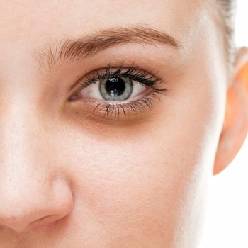 Olheiras: como ocorrem e como tratar? - Flávia Addor